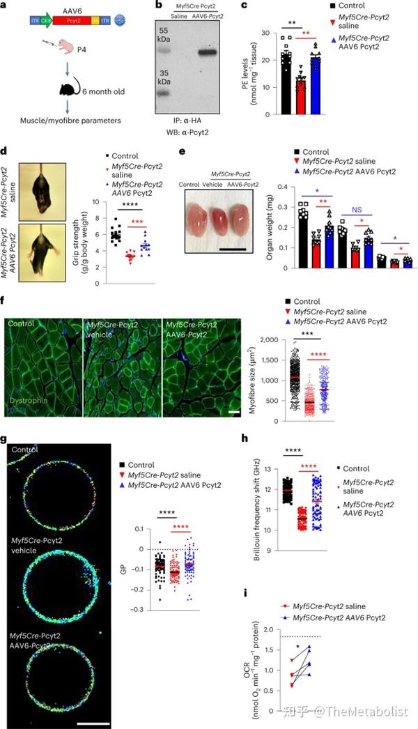 代谢学人——Nature Metabolism：PCYT2调控的脂质合成对与肌肉健康和衰老至关重要 - 知乎