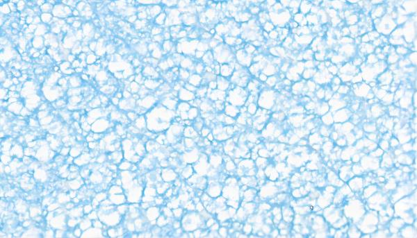 LFB髓鞘染色（步骤及流程） - 知乎