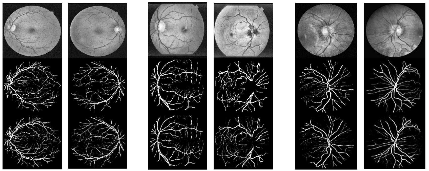 Recurrent residual U-Net for medical（循环残差U-net） - 知乎
