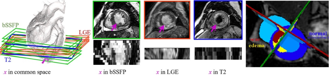 MyoPS 2020 数据集介绍 - 知乎