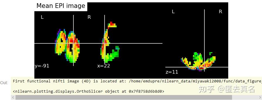 nilearn 笔记（16） - 知乎