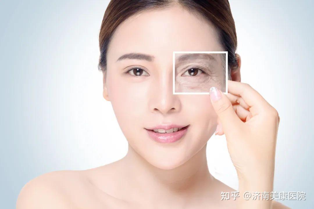 不得不承认眼窝凹陷极显老，我该怎么改善？ - 知乎