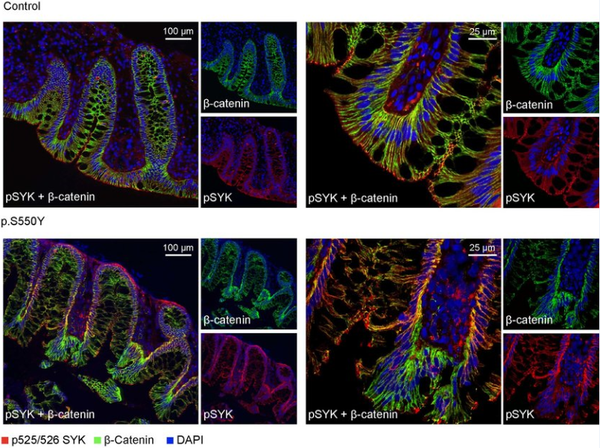 SYK与免疫失调之间千丝万缕的联系 - 知乎