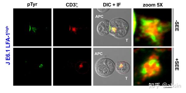 Jurkat（Clone E6-1）细胞培养攻略 - 知乎