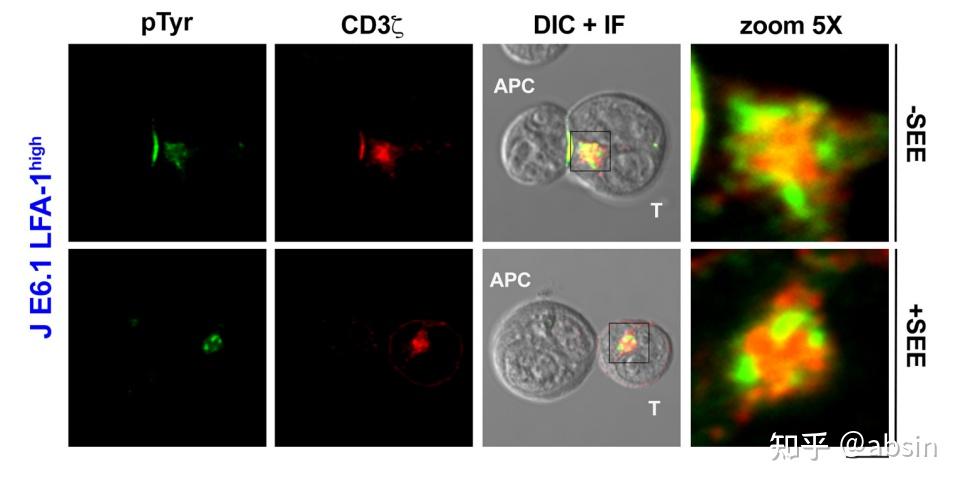 Jurkat（Clone E6-1）细胞培养攻略 - 知乎