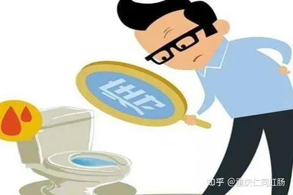 重庆医院肛肠科排名痔疮出血怎么治疗法 知乎 0528