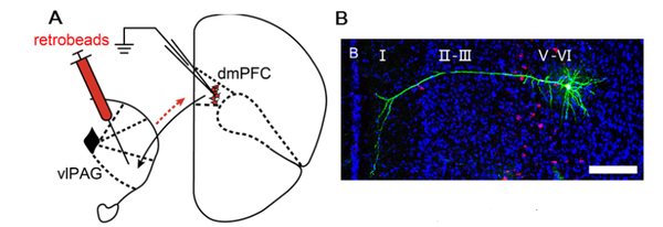 【客户文章】空军军医大学李云庆教授、董玉琳副教授团队在dmPFC-vlPAG投射神经元参与疼痛维持阈值和抗焦虑行为研究取得新进展 - 知乎