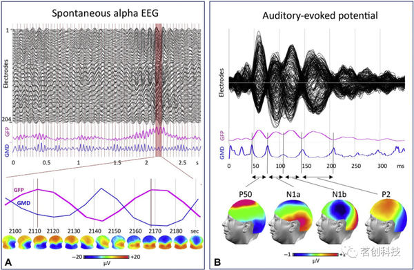 高分辨率EEG的空间分析 - 知乎
