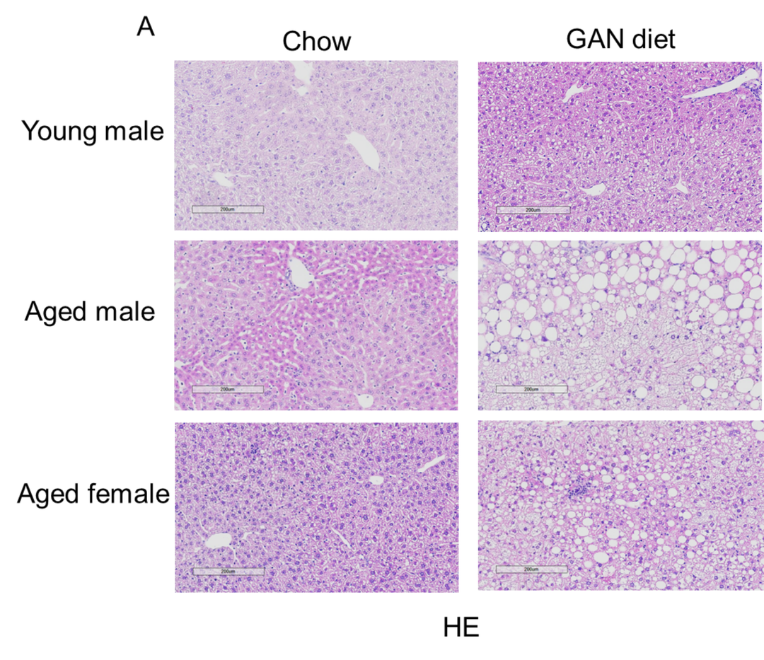GAN饮食诱导NASH模型 | 老龄鼠再展新风采，助力NASH药物研发 - 知乎