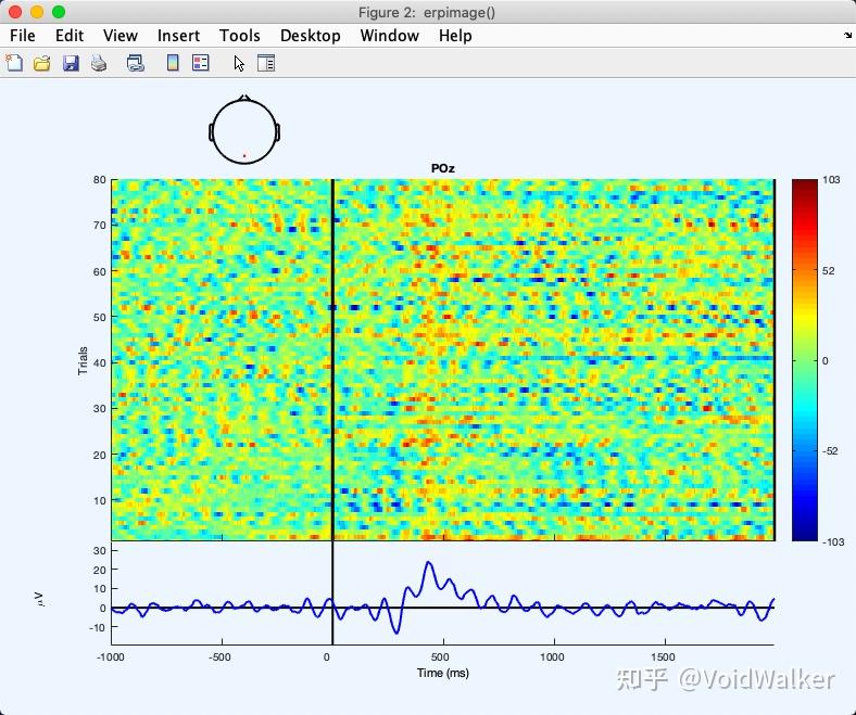 EEGLAB学习笔记--Plot data--ERP - 知乎