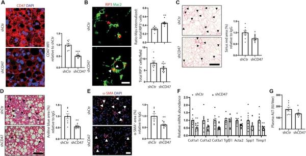 Sci Tra Med | 肝巨噬细胞清除肝炎中坏死肝细胞、减少肝纤维化 - 知乎