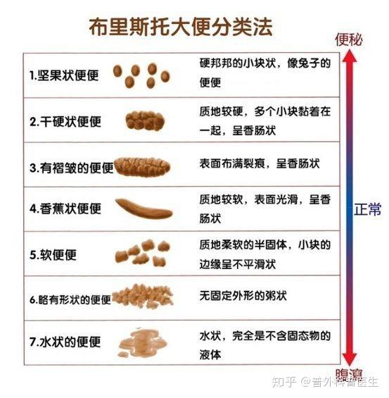 十女十痔，为什么痔疮更青睐女性，医生教你如何防治 知乎 8031