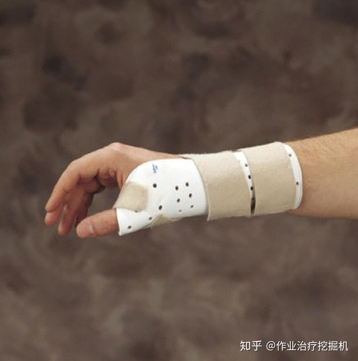 屈肌肌腱损伤康复的一些思考 - 知乎