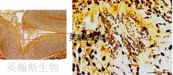 Warthin-Starry银染方法 - 知乎