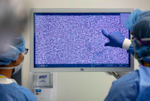 Nat Biomed Eng | 将组织图像从冷冻切片转变为FFPE的深度学习模型 - 知乎