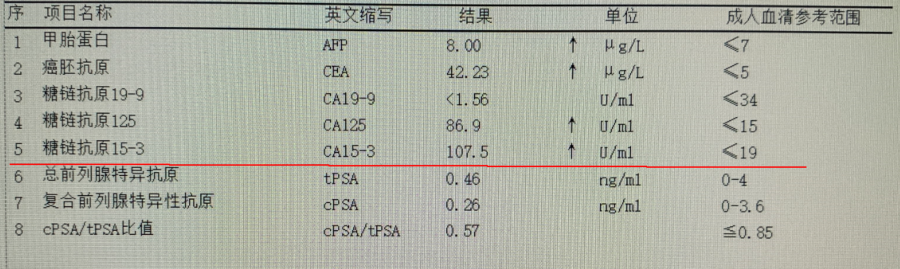肿瘤标志物——CA153 - 知乎