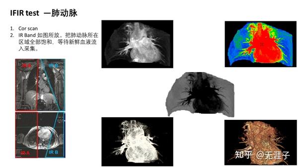 IFIR成像技术 - 知乎