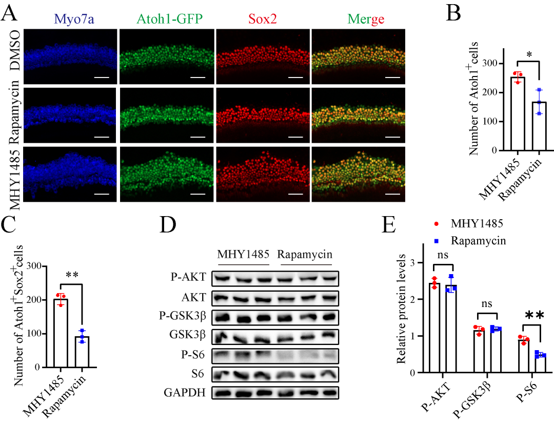 Adv Sci︱东南大学柴人杰团队在耳蜗类器官功能性毛细胞再生方面取得重要进展 - 知乎