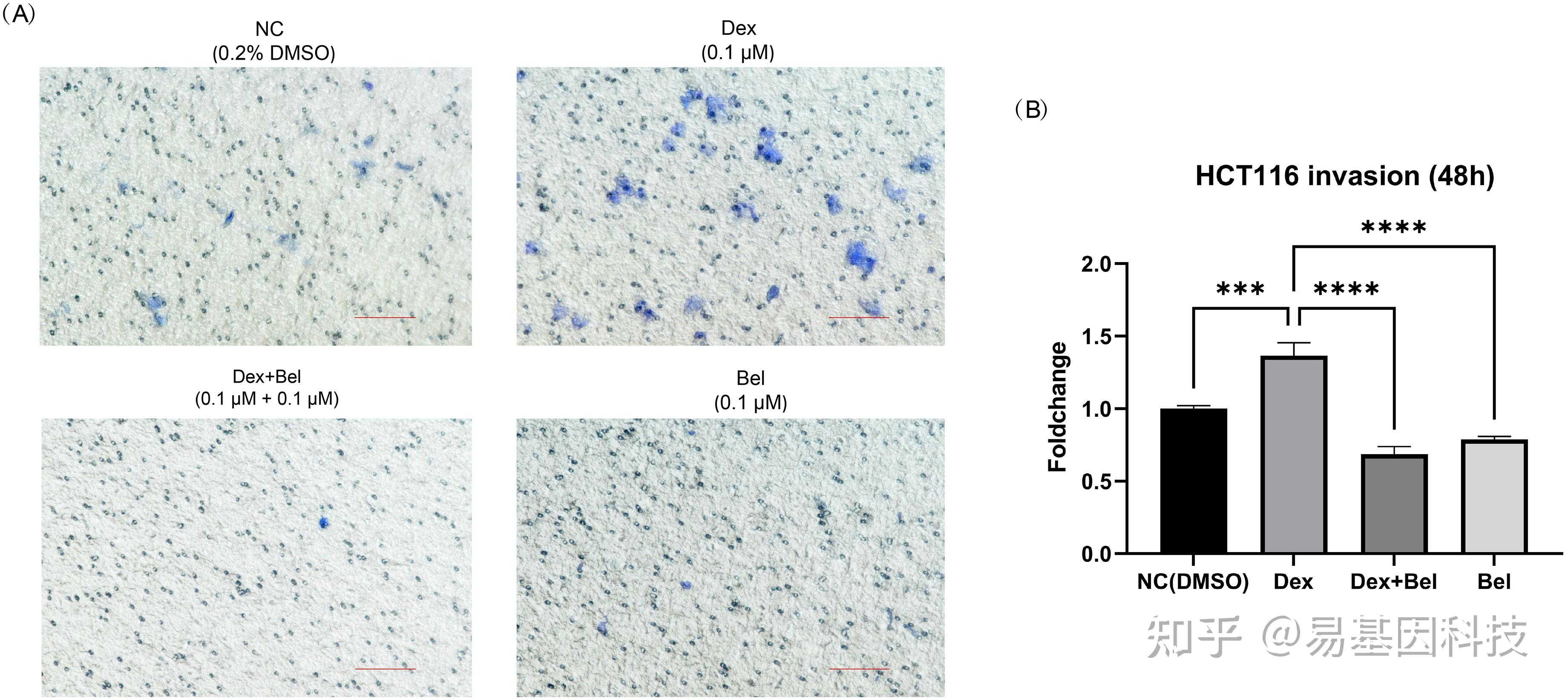 易基因： ChIP-seq等揭示糖皮质激素和TET2共调控促进癌症转移的表观遗传机制｜项目文章 - 深圳市易基因科技 - 博客园