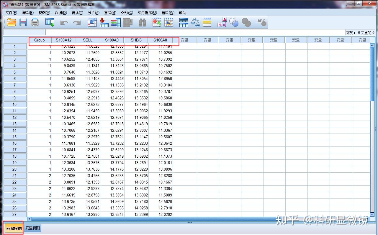 如何用SPSS做ROC曲线，检测预测模型的准确性 - 知乎