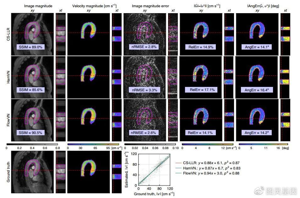 Nature子刊 | 深度神经网络加速4D Flow MRI图像重建 - 知乎