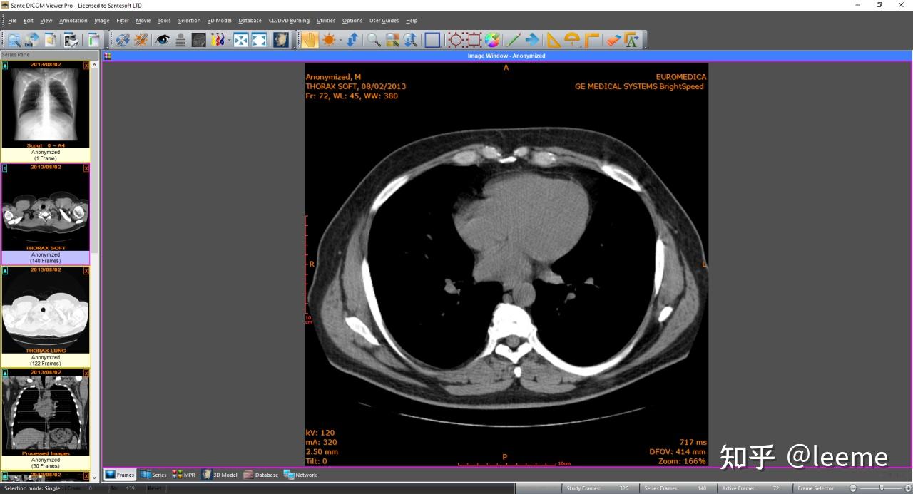 世界著名医疗影像软件介绍 - 知乎