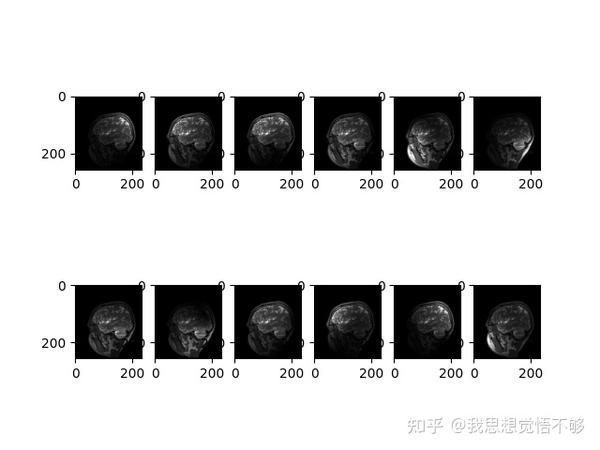 MRI重建中的小实验（python） - 知乎