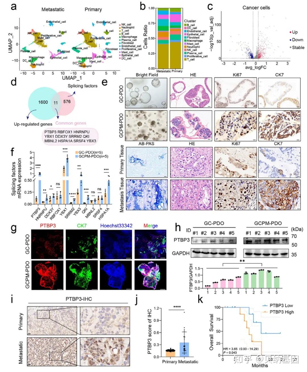 项目文章 | 苏大一附院破解胃癌腹膜转移难题！靶向PTBP3/COX11剪接轴，铜死亡疗法显神威！ - 知乎
