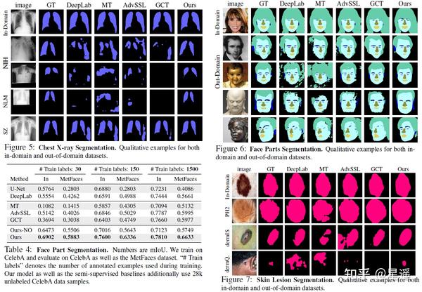 Semantic Segmentation with Generative Models - 知乎