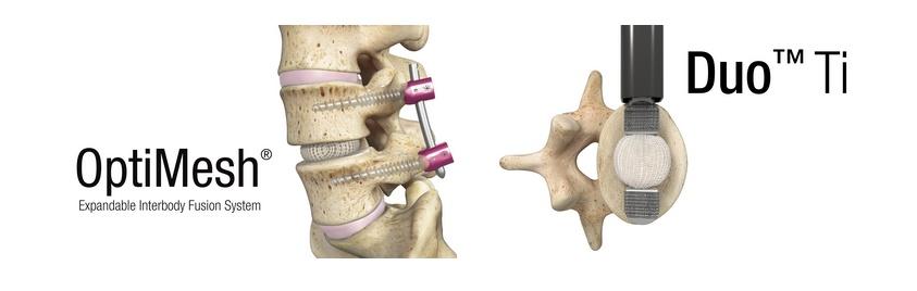 全球唯一！经内镜脊柱融合系统 - 知乎
