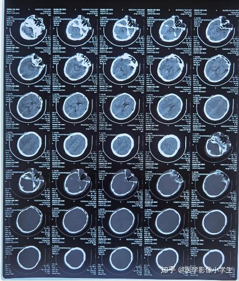 如何分辨DR、CT、MR，以及胶片前后左右定位？ - 知乎