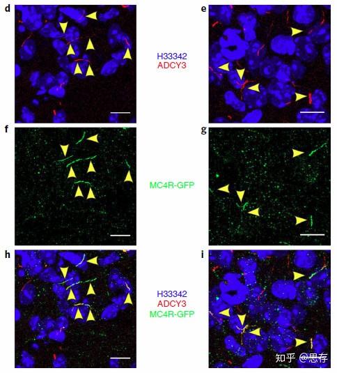 Origene旗下皇冠质粒：ADCY3过表达质粒 - 知乎