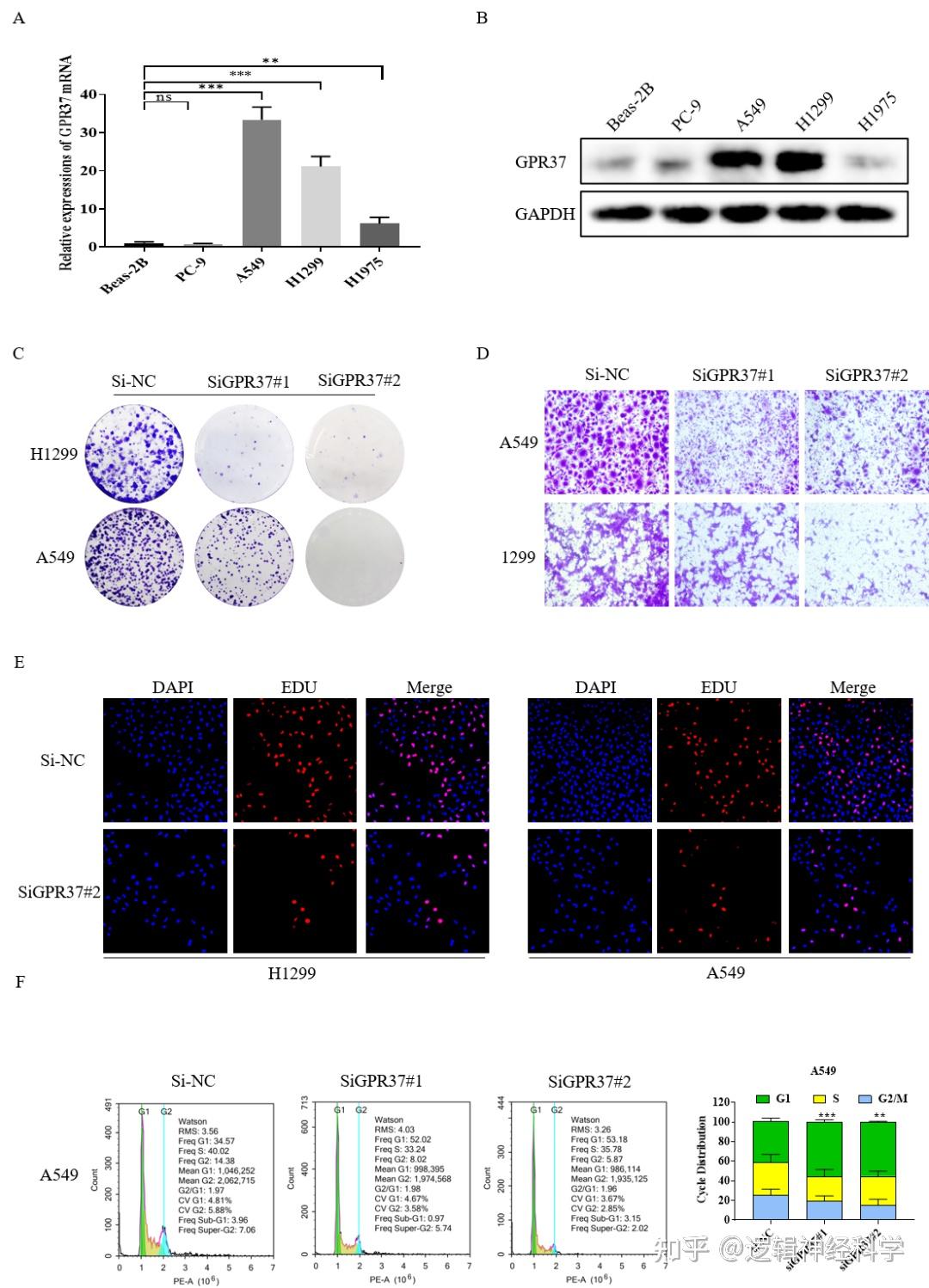 Pharmacol Res |温州医科大学黄晓颖/赵承光团队研究发现GPR37有望成为肺腺癌治疗的新靶点 - 知乎