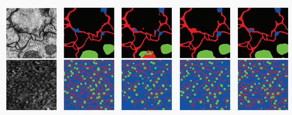 CVPR2020 | 细胞图像分割的反馈U-net方法 - 知乎