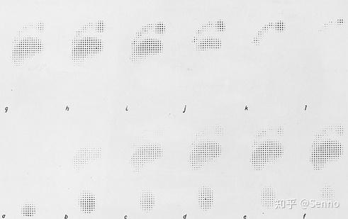 【曼氏足踝-第3讲】足踝部的生物学机制——足底压力的测量 - 知乎