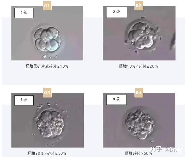 试管反复失败?胚胎碎片要重视! 知乎