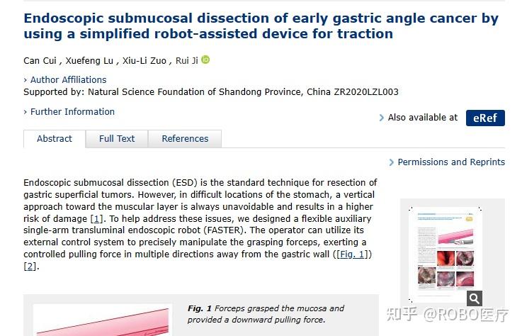 从ESD到Robot-assisted-ESD，EndoFaster提供新策略 - 知乎