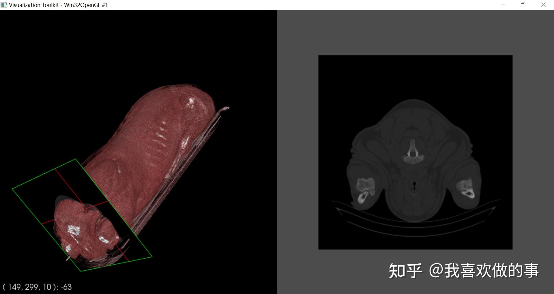 01 VTK体绘制（Volume Rendering）+ vtkImagePlaneWidget交互显示横截面 - 知乎