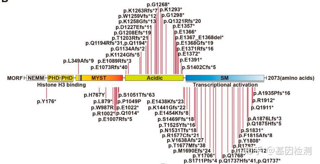 KAT6B基因关联表型差异 - 知乎