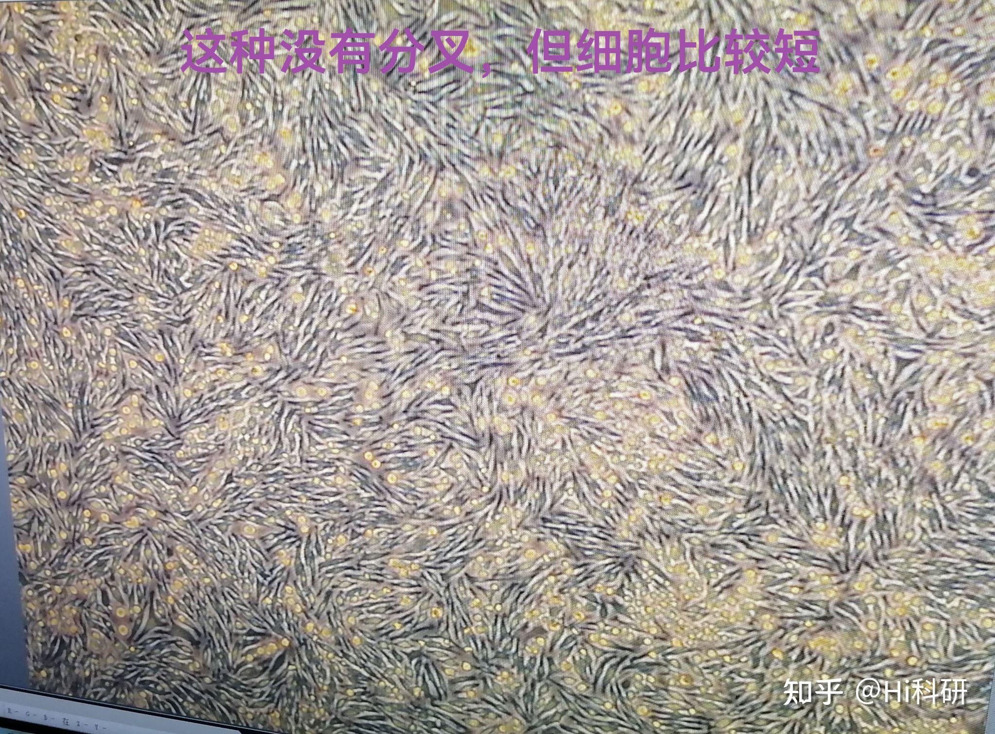 BMDM小鼠骨髓源性原代细胞培养 生物实验 研究生 - 知乎