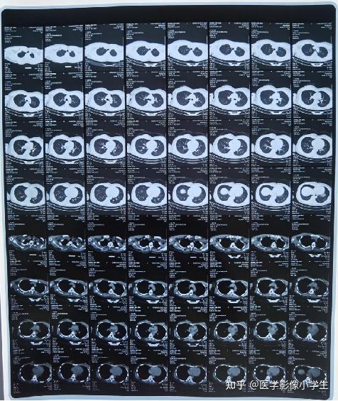 如何分辨DR、CT、MR，以及胶片前后左右定位？ - 知乎