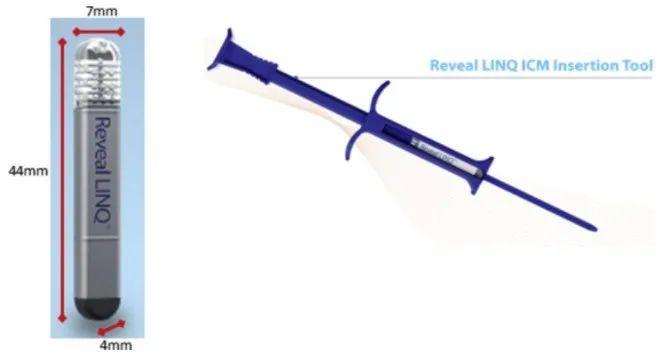 植入型心电监测仪（ICM）产品梳理 - 知乎