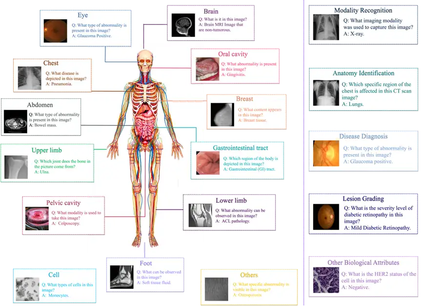 CVPR 2024 | OmniMedVQA：大规模医学多模态 VQA 评测数据集 - 知乎