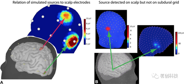 高分辨率EEG的空间分析 - 知乎
