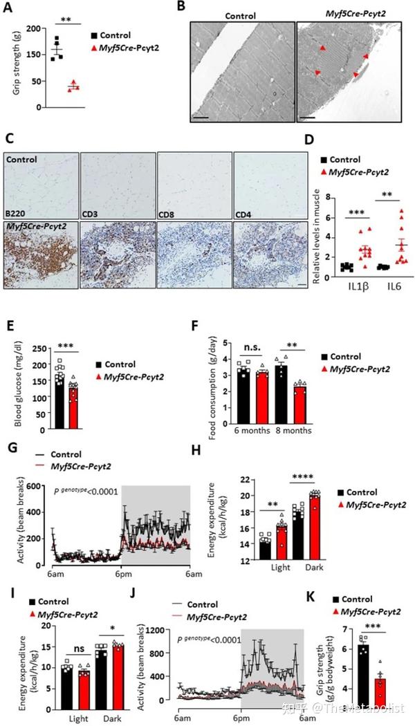 代谢学人——Nature Metabolism：PCYT2调控的脂质合成对与肌肉健康和衰老至关重要 - 知乎