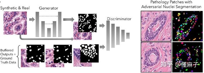 计算病理学-细胞核分割 - 知乎