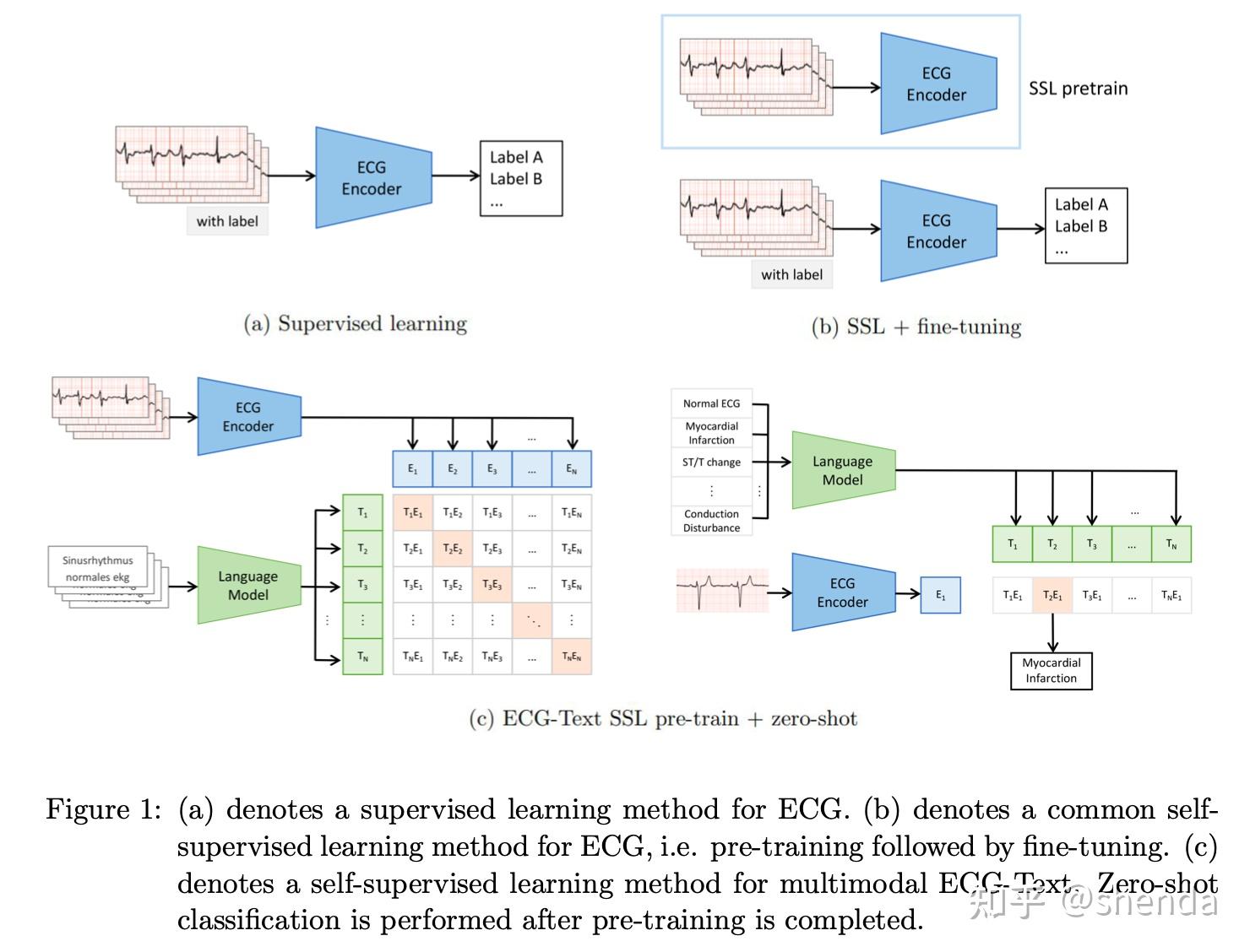 [MIDL 2023] 利用语言模型帮助心电信号零样本学习 - 知乎