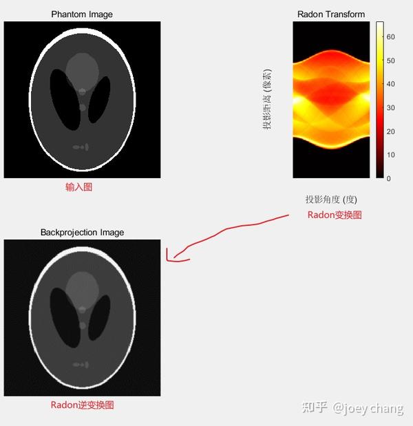 看透CT成像的背后秘密：Radon 变换在医学影像中的应用 - 知乎