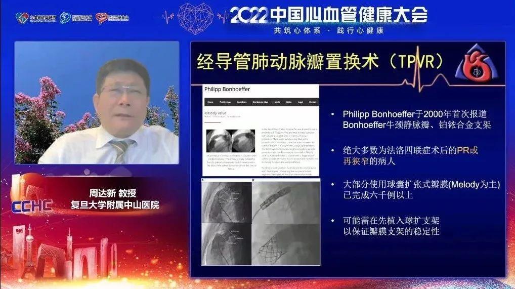 2022 CCHC丨周达新教授：经导管肺动脉瓣介入治疗的年度进展 - 知乎