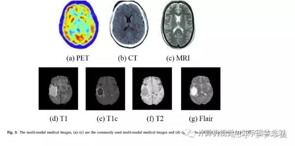 【多模态数据处理】关于多模态医学图像分割的综述 - 知乎